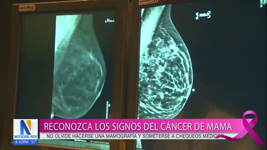 Médicos informan sobre los síntomas del cáncer de seno