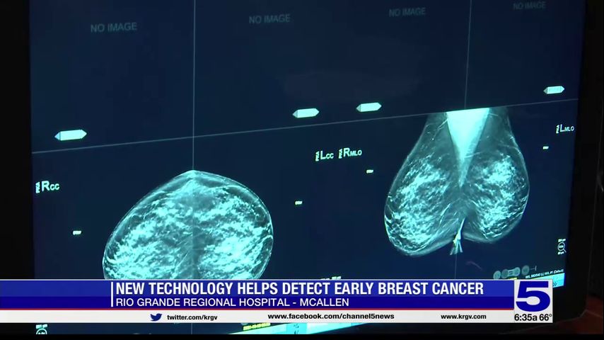 New technology helps detect early breast cancer