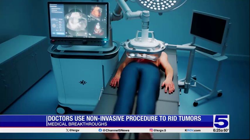 Medical Breakthroughs: Doctors use non-invasive procedure to get rid of ...