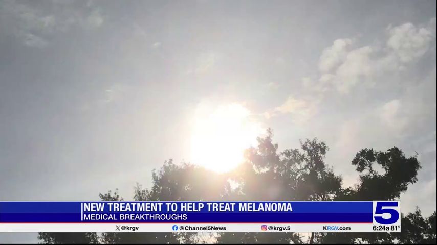 Medical Breakthroughs: New treatment to help treat melanoma