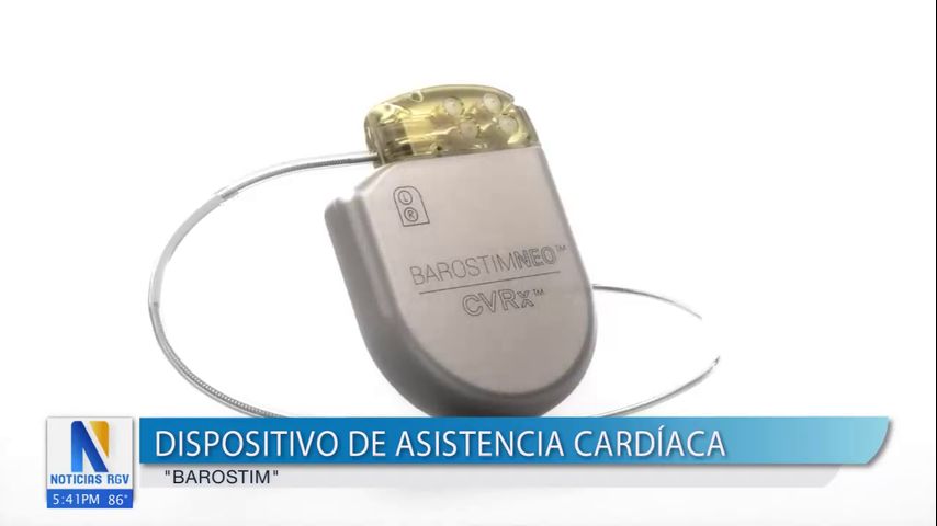 Salud y Vida: Dispositivo de asistencia cardiaca Barostim