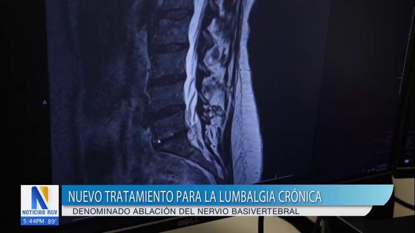 Salud y Vida: Aprueban nuevo tratamiento para la lumbalgia crónica