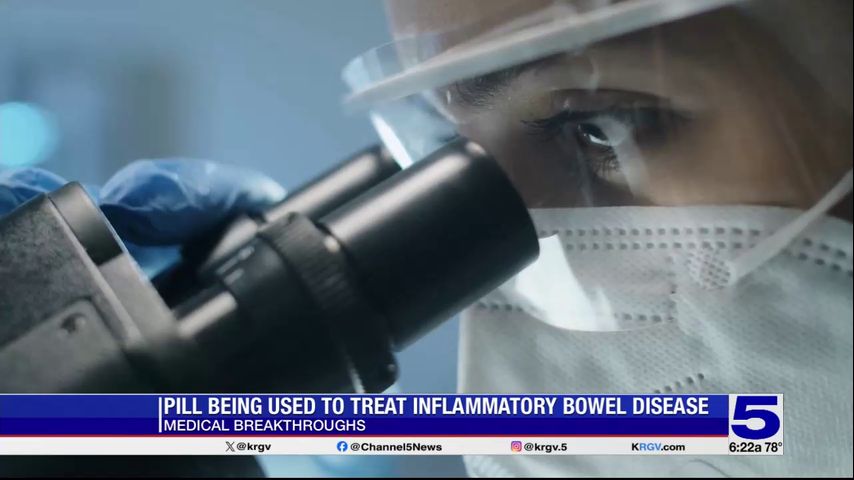 Medical Breakthroughs: Pill being used to treat inflammatory bowel disease