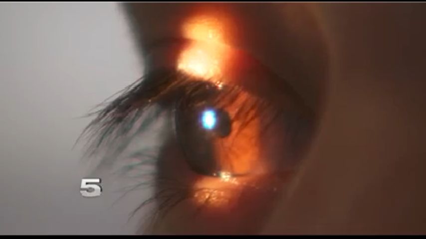 Expert Explains Retina Damage Warning Signs after Solar Eclipse