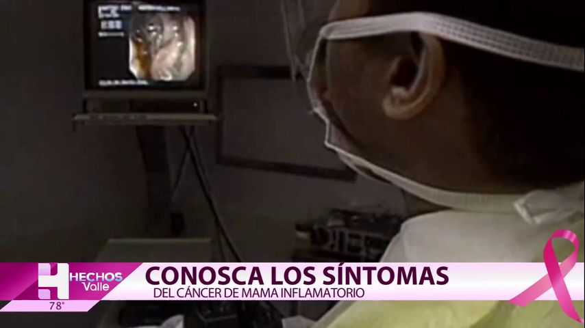 Conozca los síntomas de cáncer de mama inflamatorio